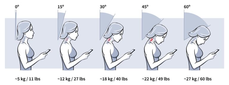 Handynacken – Symptome, Behandlung & Übungen